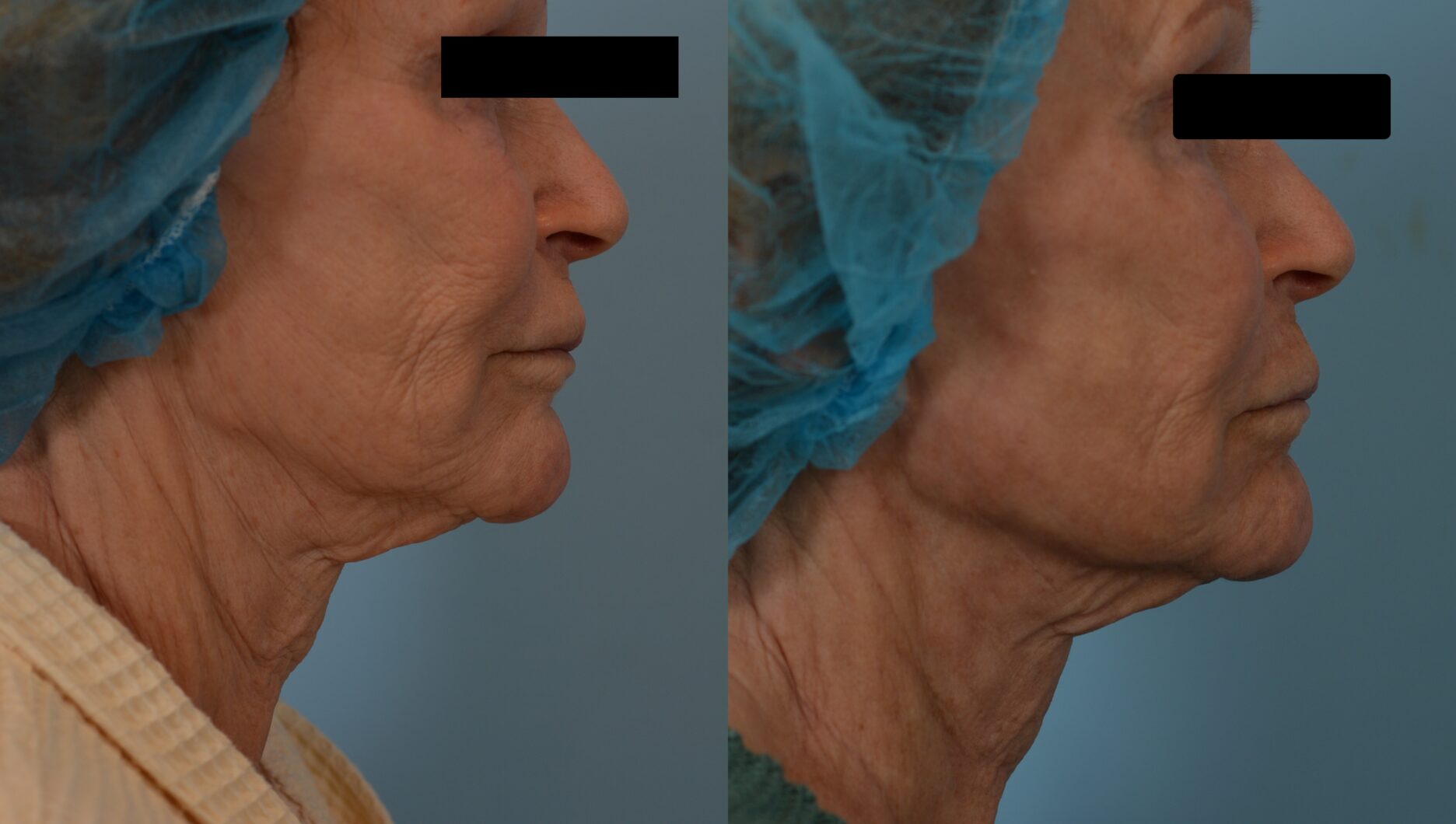 UltraClear® Laser Portland| Located Near Beaverton