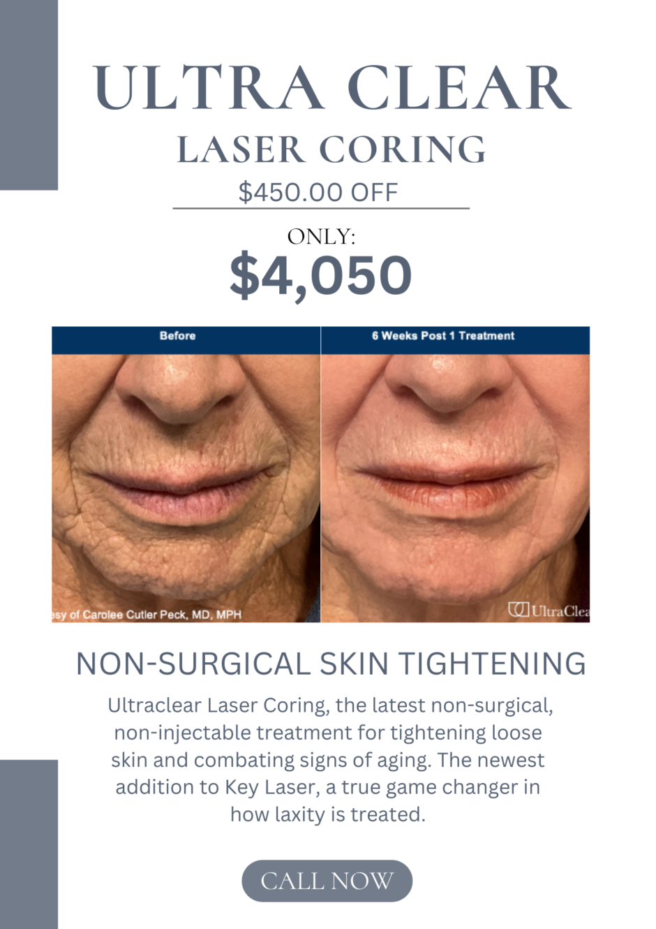 Specials Portland Med Spa | Located near Beaverton, OR