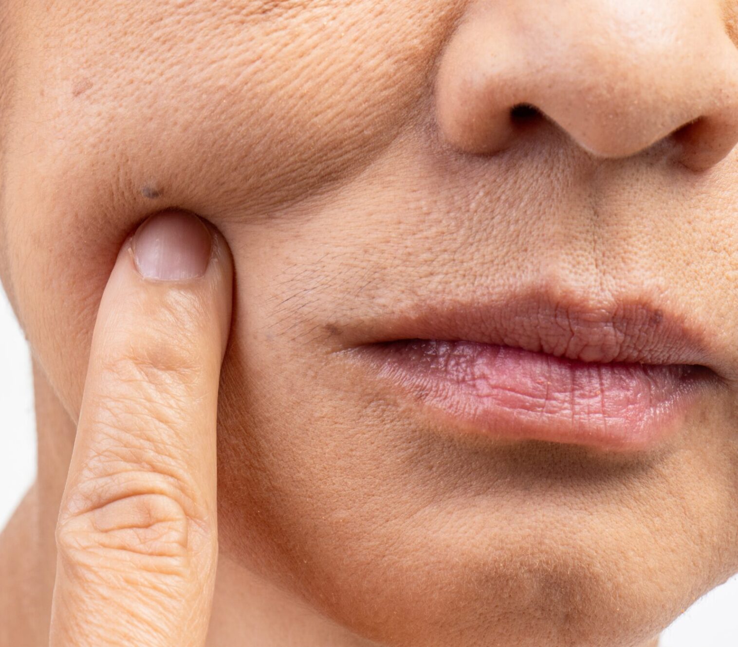 Skin Laxity Treatment in Portland, OR | Key Laser Institute